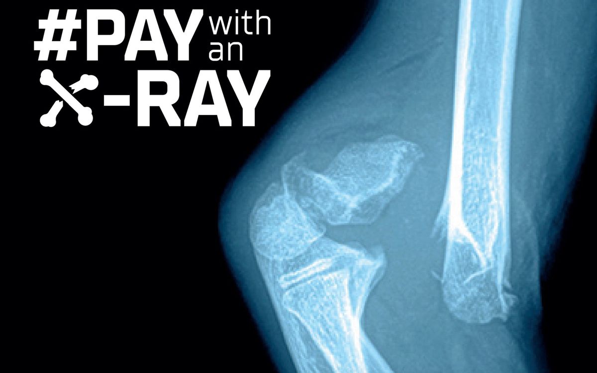 Wintersporters die een botbreuk oplopen mogen gratis skiën bij ...